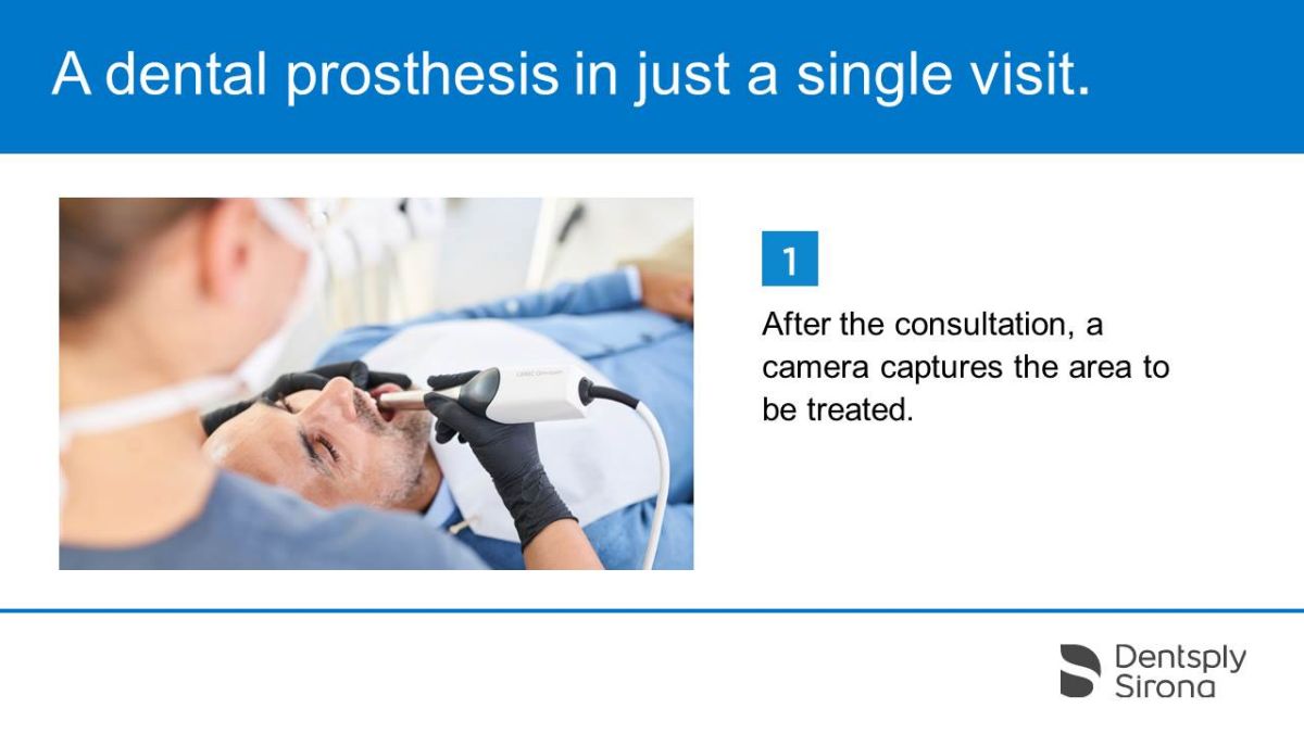 Single-Visit Tooth Restoration - CEREC | Rushmore Dental